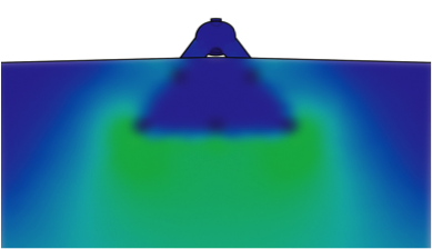 Brow Lifts - Richard Weiss M.D. - Cosmetic and Reconstructive Eyelid ...